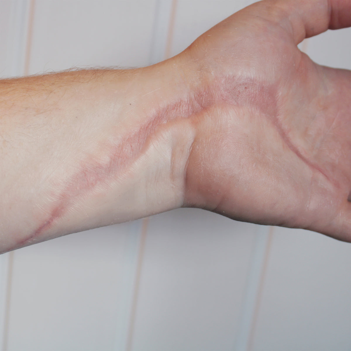 Jess FX - Large Wound Scar Prosthetic (Silicone) | Titanic FX